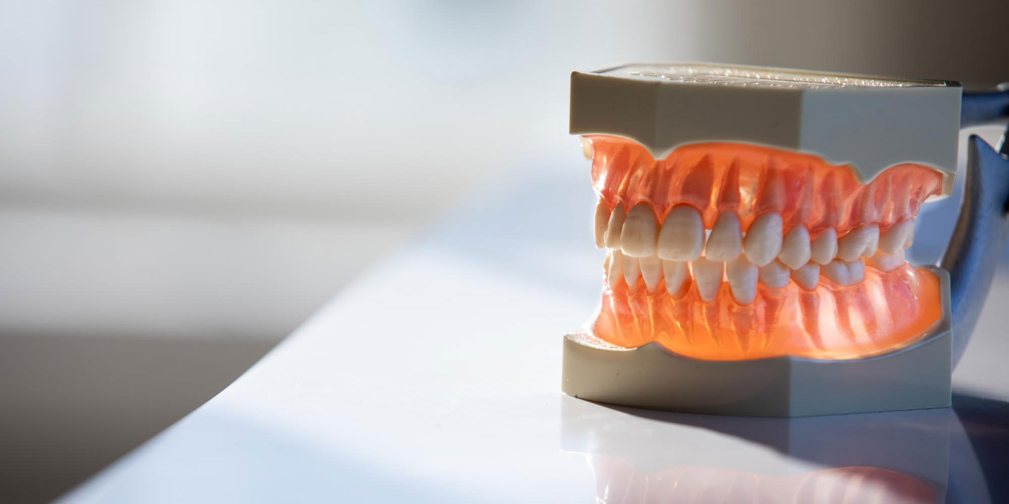 dentures-model – Soheil Samiei D.M.D., P.C